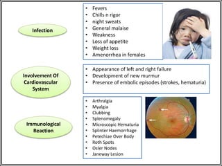 Infective Endocarditis Paediatrics | PPTX