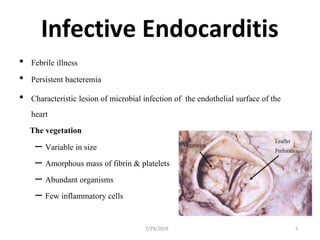 Infective endocarditis | PPT