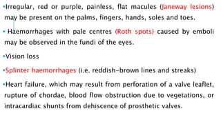 Infective endocarditis | PPT