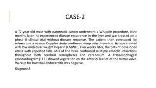 Infective endocarditis | PPT
