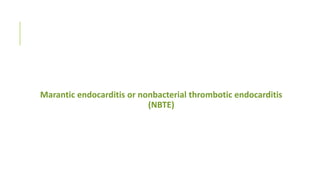 Infective endocarditis | PPTX