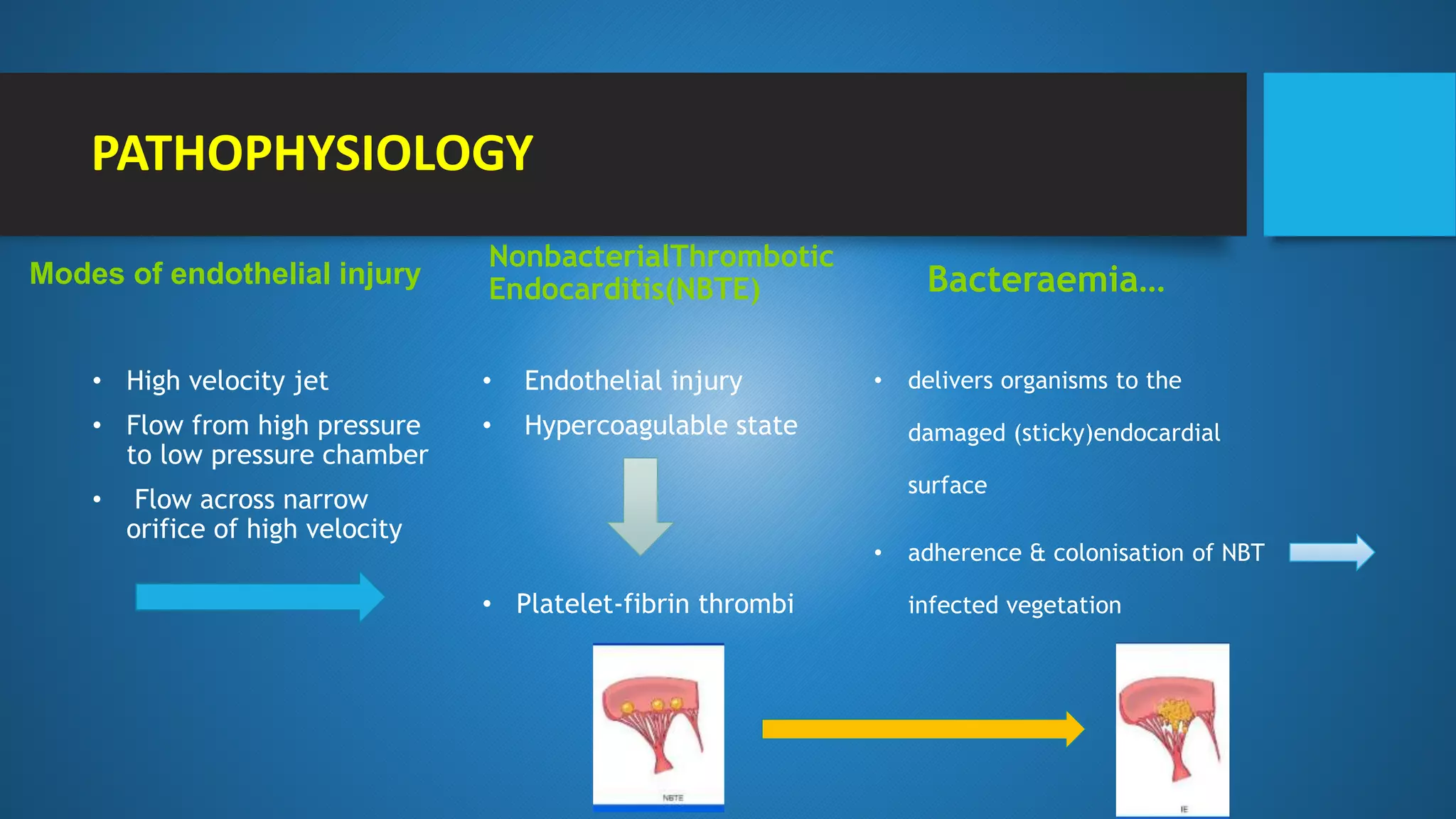 Infective endocarditis | PPTX