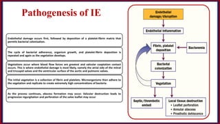 Infective Endocarditis | PDF