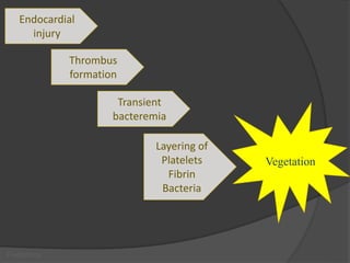 Infective Endocarditis.ppt