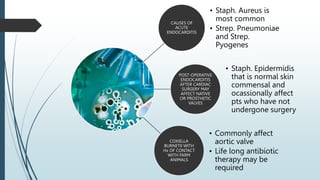 INFECTIVE ENDOCARDITIS.pptx by Dr. Humna | PPT