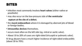 INFECTIVE ENDOCARDITIS.pptx1235678900000 | PPT