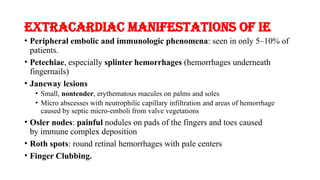 INFECTIVE ENDOCARDITIS PATHOPHYSIOGY DIAGNOSIS AND MANAGEMENT. | PPT
