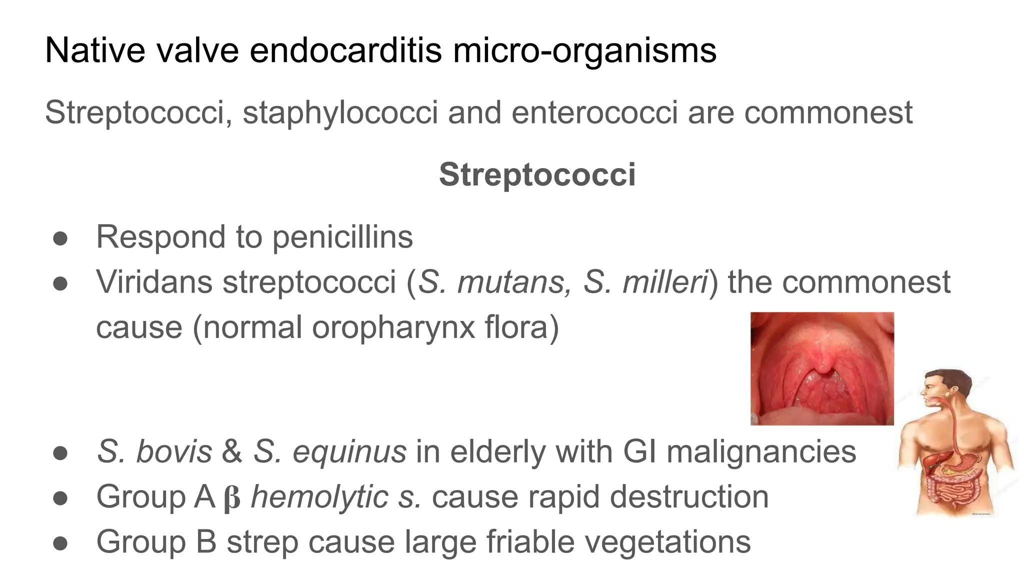 Infective endocarditis_032548.pdfjhcdfgjhcd | PDF