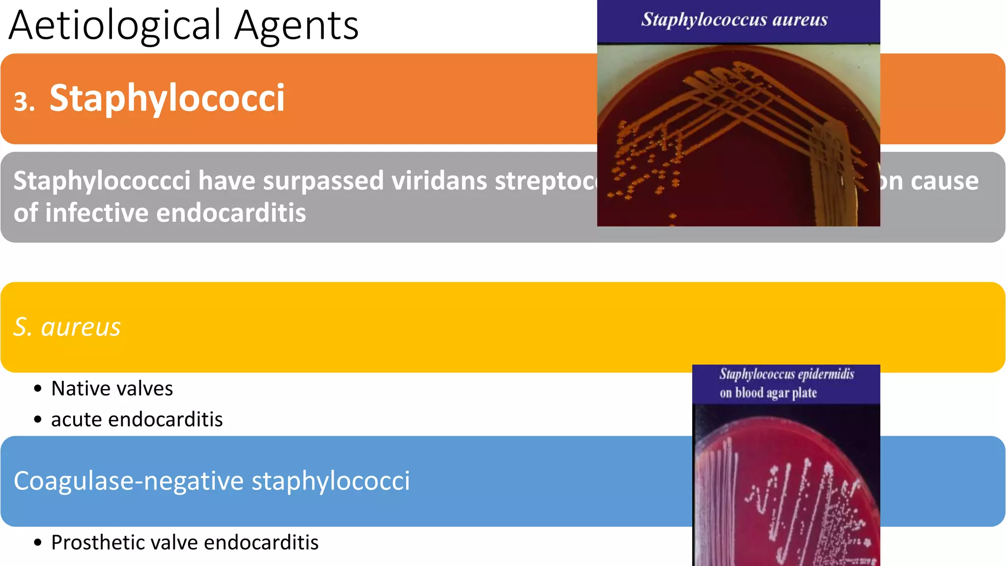 Infective endocarditis ESC guidelines Ahmed Yehia. MD | PPTX