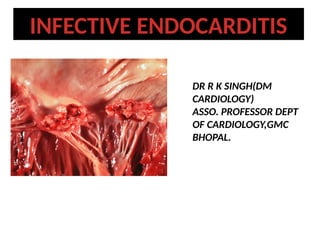 INFECTIVE ENDOCARDITIS PPT for Medical Graduates | PPT