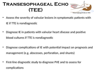 INFECTIVE ENDOCARDITIS PPT for Medical Graduates | PPTX