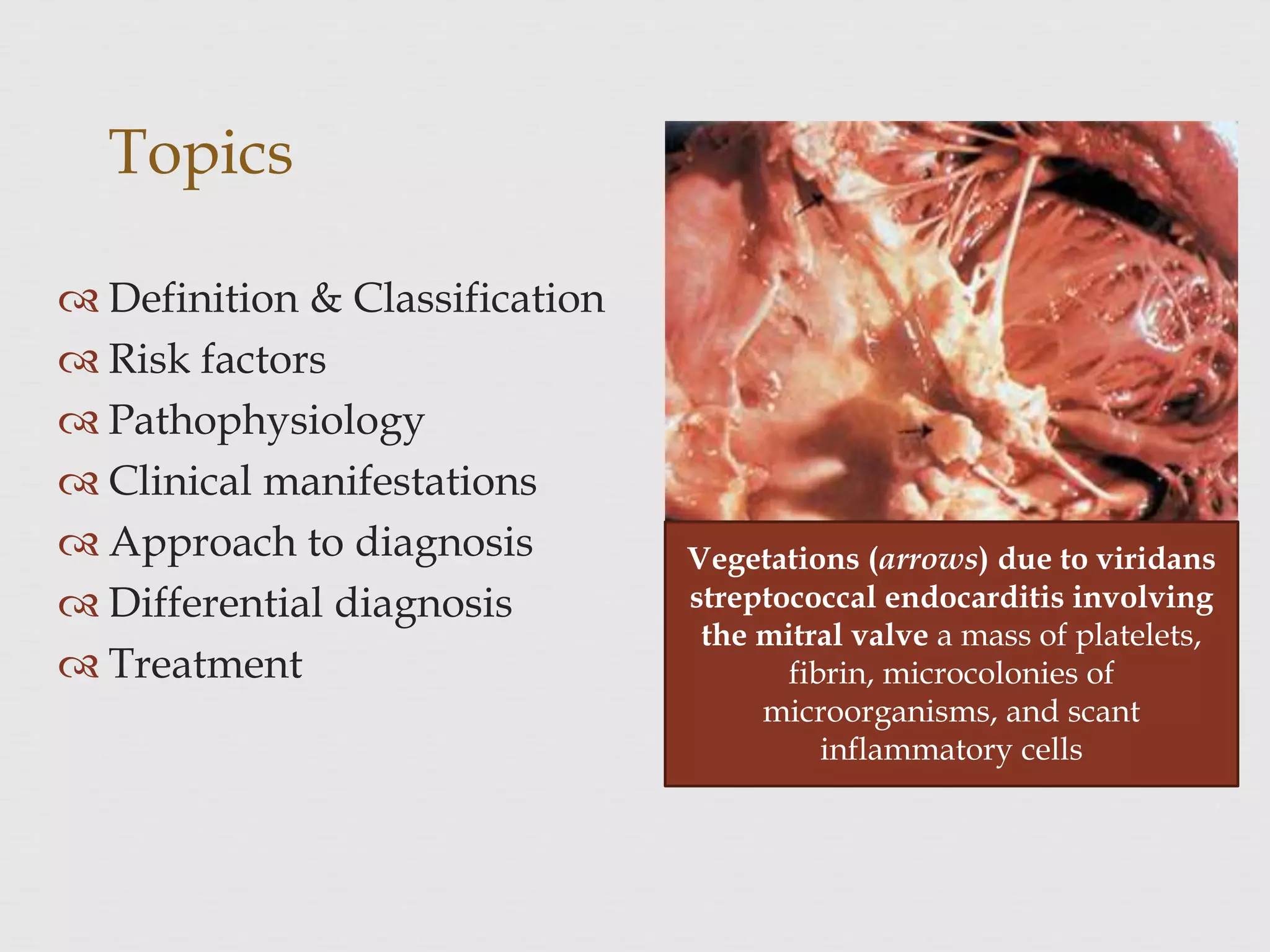 Infective endocarditis updated | PPTX
