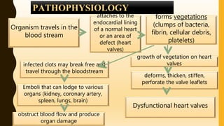 Endocarditis ( Inflammatory disease of the Heart | PPT