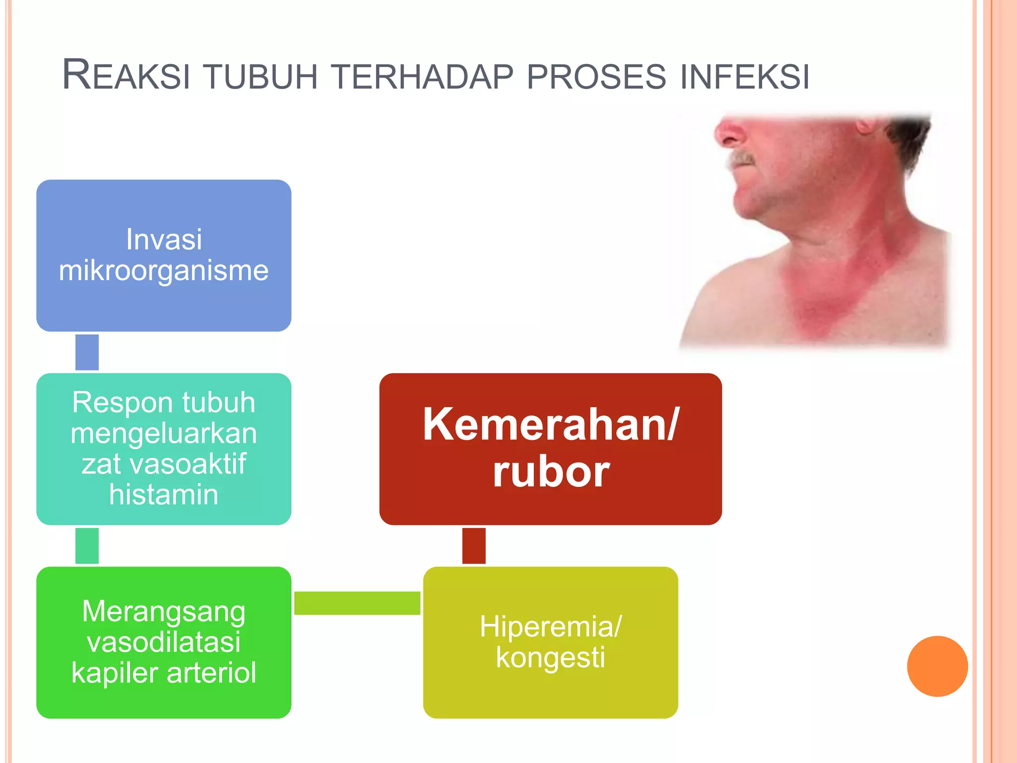 INFEKSI | PPTX