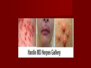 mengenali ims dan pencegahan terhadap penularan.ppt