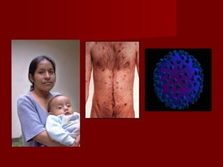 mengenali ims dan pencegahan terhadap penularan.ppt