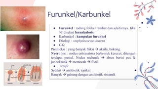 Infeksi Bakteri 210.pptx