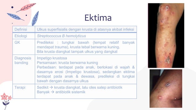 Infeksi Bakteri 210.pptx