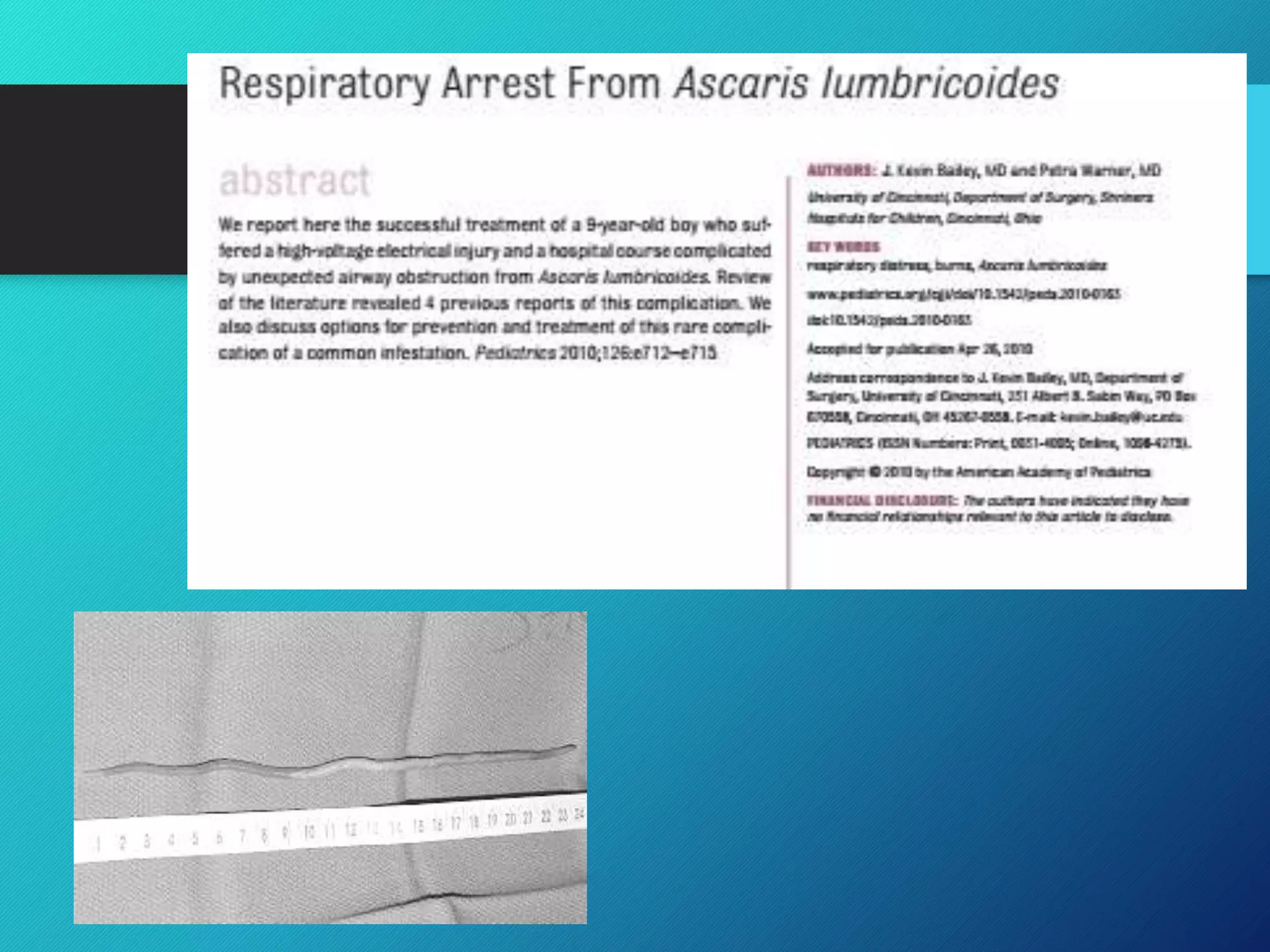 Infeksi cacing pada manusia | PPSX