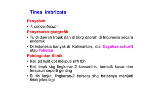 Infeksi Jamur pembagian dan tatalaksana slide | PPTX