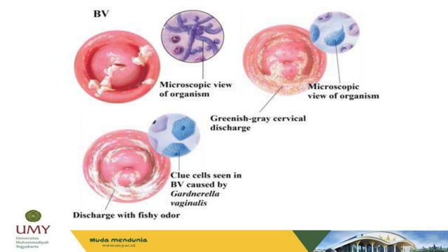 Infeksi Menular Seksual (IMS)-dikompresi.pdf