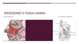 Infeksioni i fossa canina shqip - ideal sallauka | PPTX