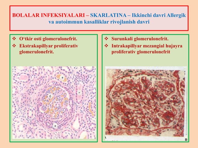 SamDTU patanatomiya kafedrasi INFEKSION KASALLIKLAR.ppt