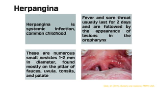 Infeksi Rongga Mulut di kepala leher.pptx
