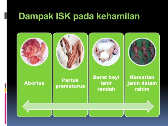 Infeksi saluran kemih | PPTX