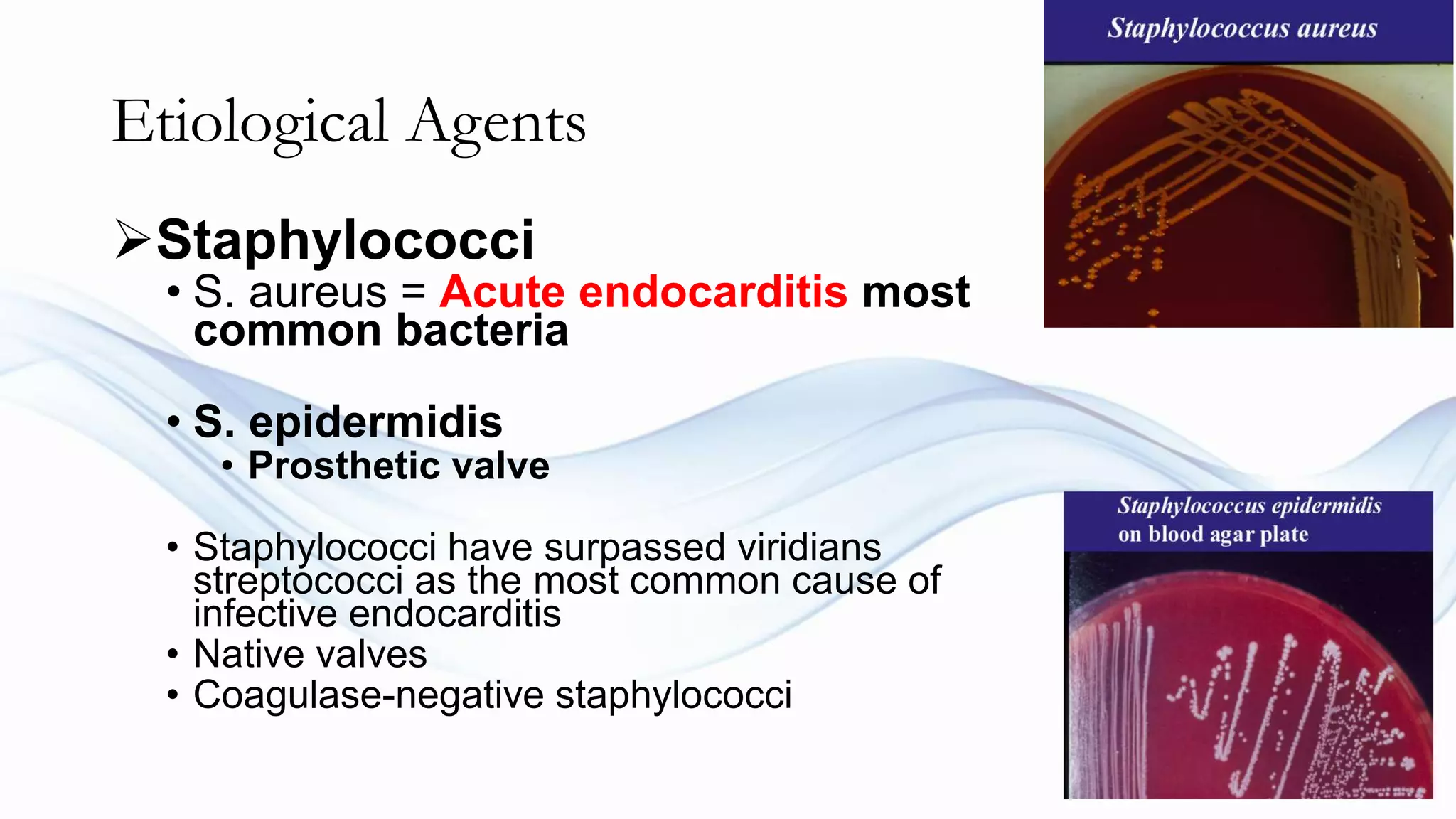 infectious endocarditis.pptx