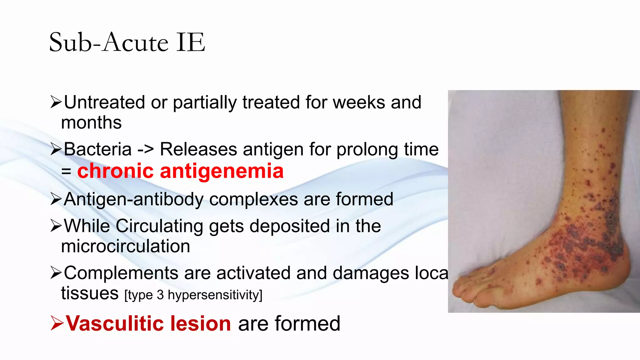 infectious endocarditis.pptx