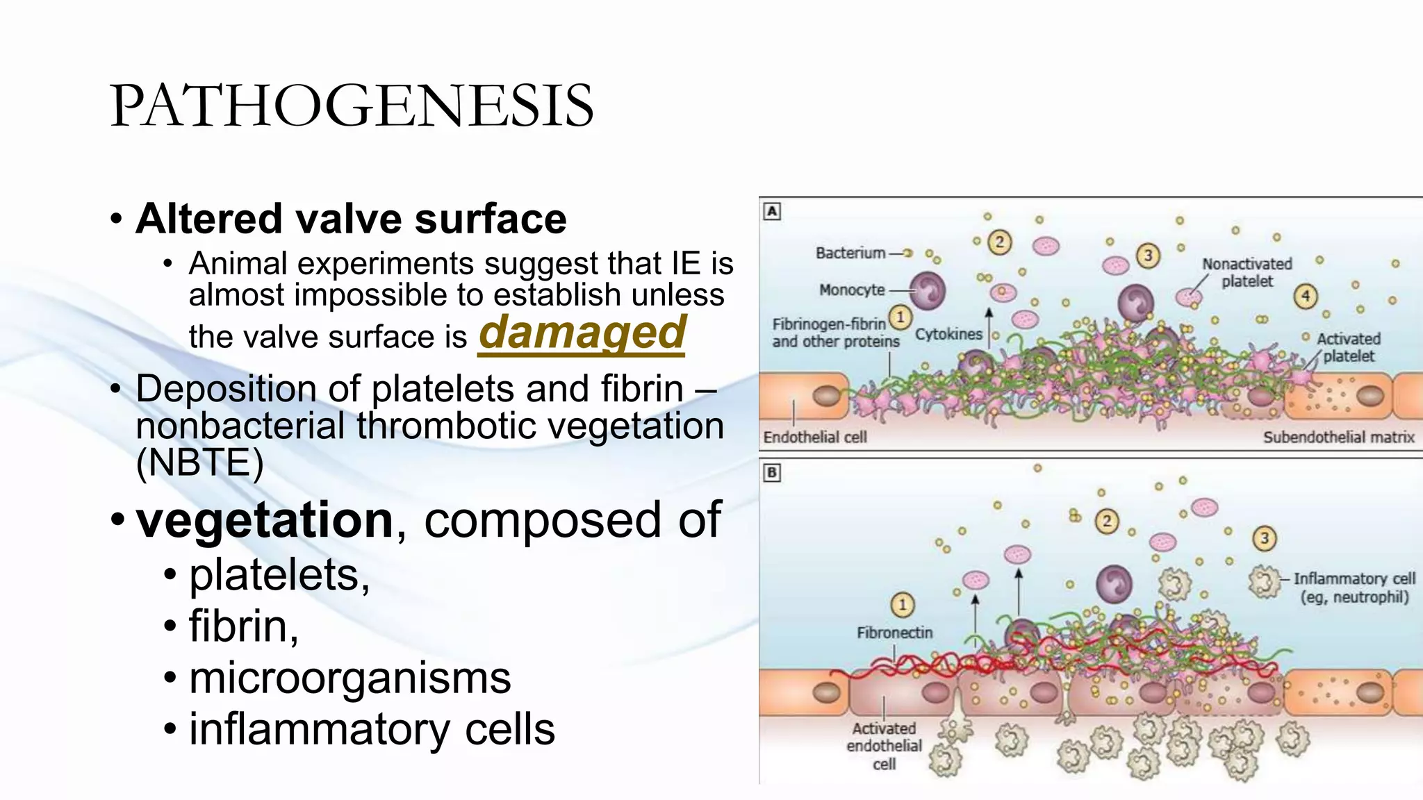 infectious endocarditis.pptx