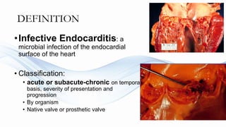 infectious endocarditis.pptx