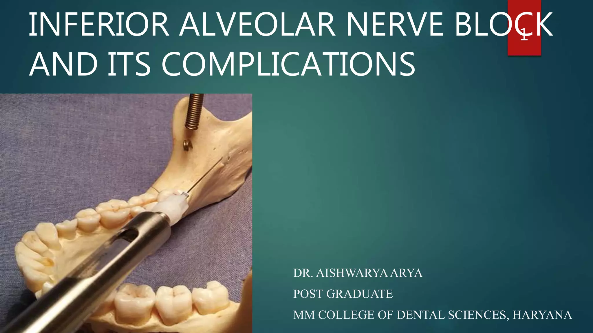 Inferior alveolar nerve | PPTX