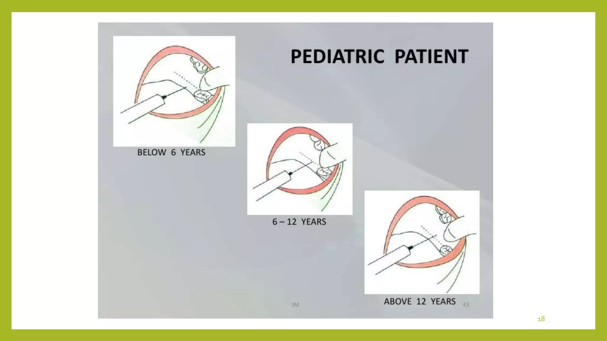 Inferior Alveolar Nerve Pptx