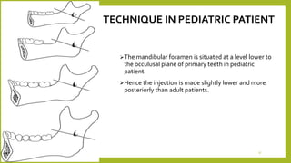 Inferior alveolar nerve | PPTX