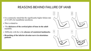 Inferior alveolar nerve | PPTX