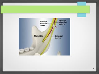 Inferior alveolar nerve block | ODP
