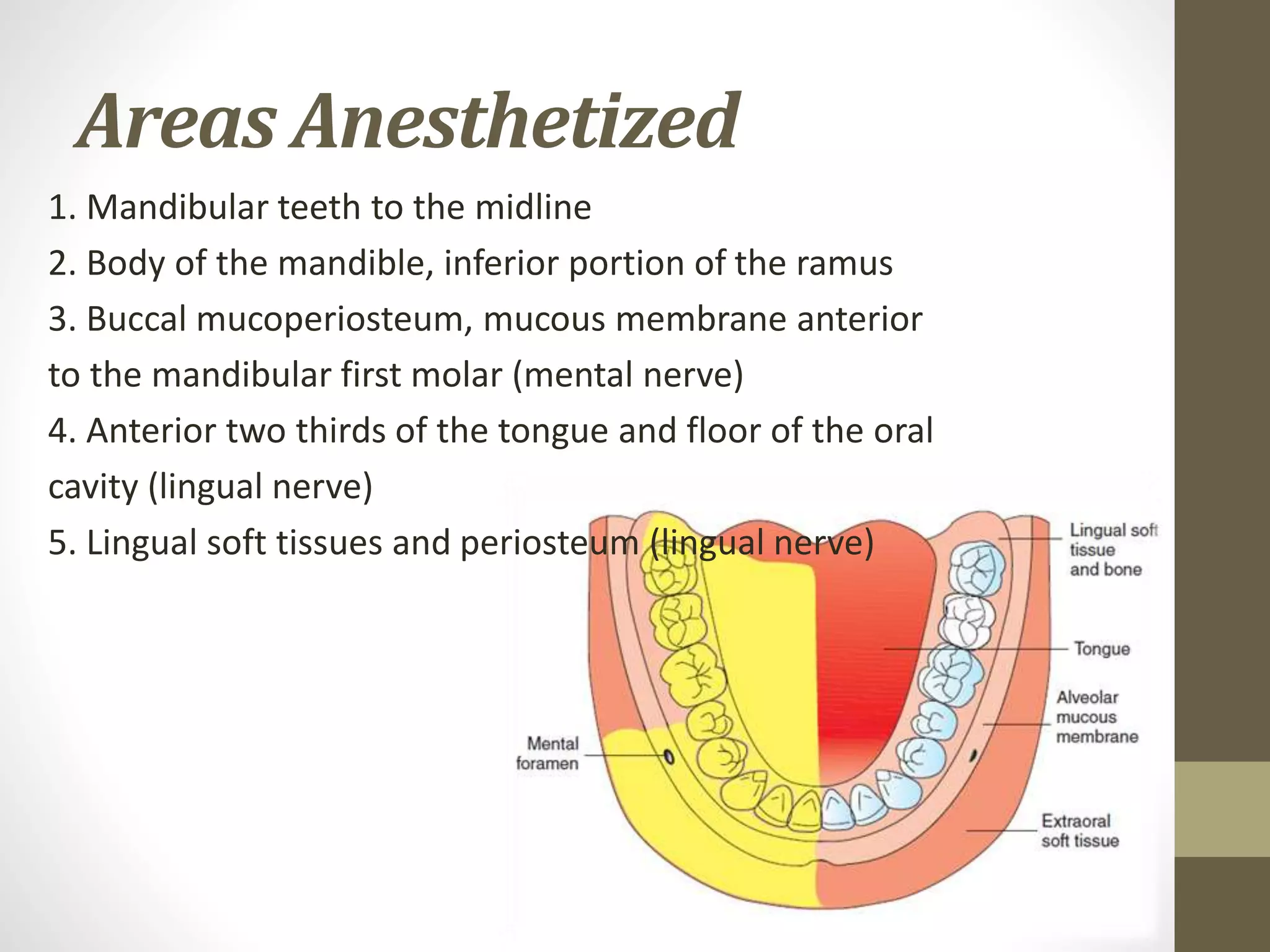 Mandibular Anesthesia : Inferior alveolar nerve block | PPTX