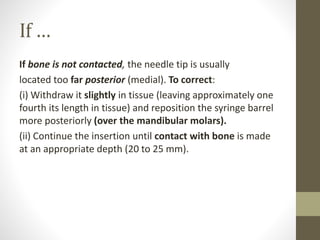 Mandibular Anesthesia : Inferior alveolar nerve block | PPTX