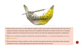 Inferior alveolar nerve injury | PPTX