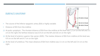 Inferior epigastric vessels injury; What to do ? | PPTX