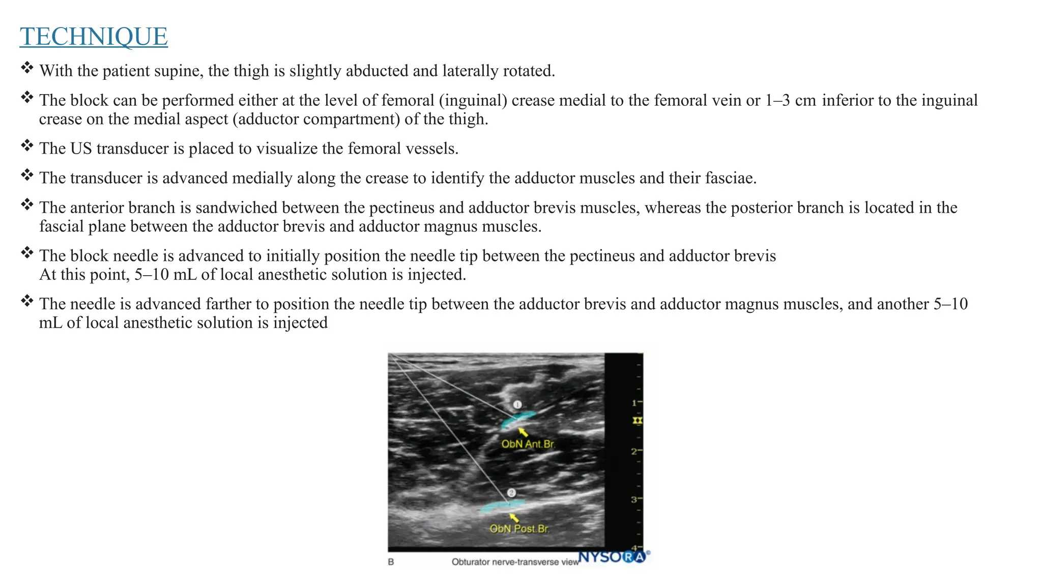INFERIOR LIMB NERVE BLOCKS ultrasound guided.pptx