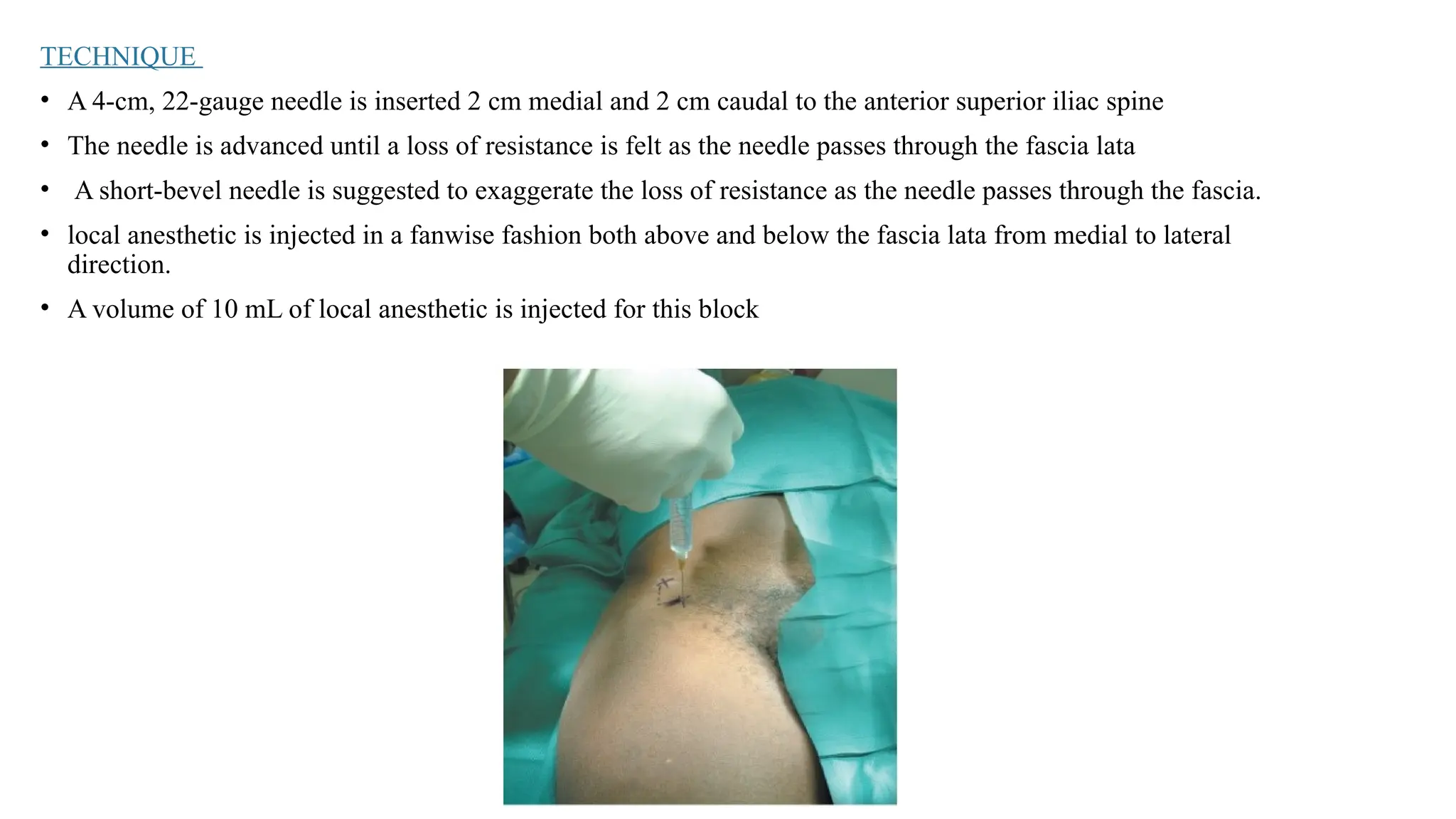 INFERIOR LIMB NERVE BLOCKS ultrasound guided.pptx