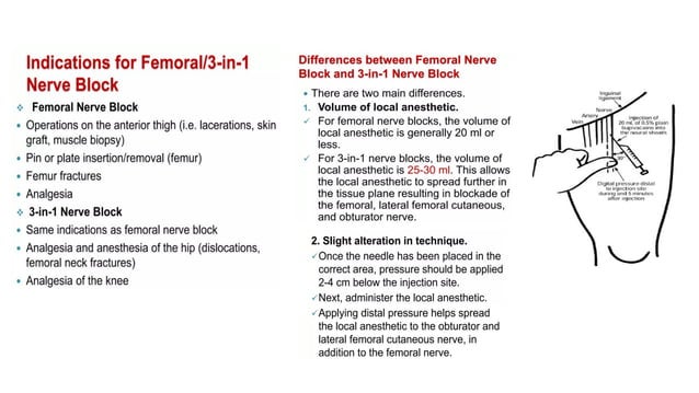 INFERIOR LIMB NERVE BLOCKS ultrasound guided.pptx
