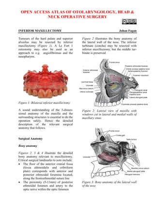 Inferior Maxillectomy oh head and neck surgery | PDF