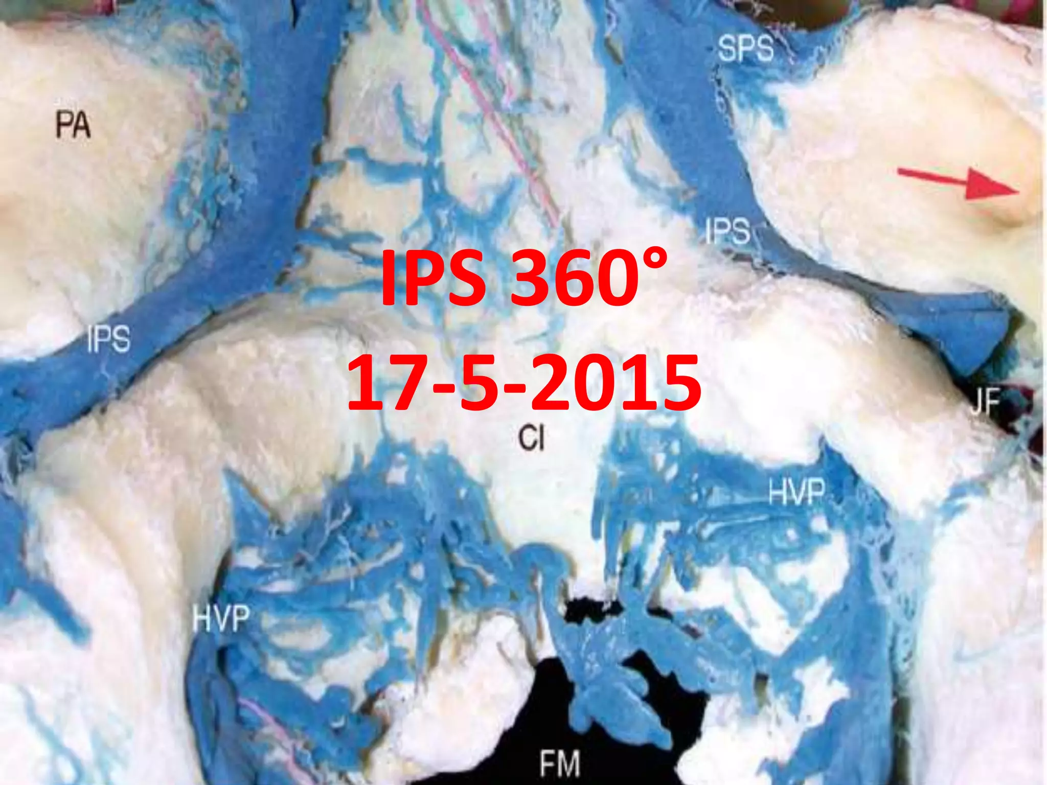 Inferior petrosal sinus 360° | PPTX