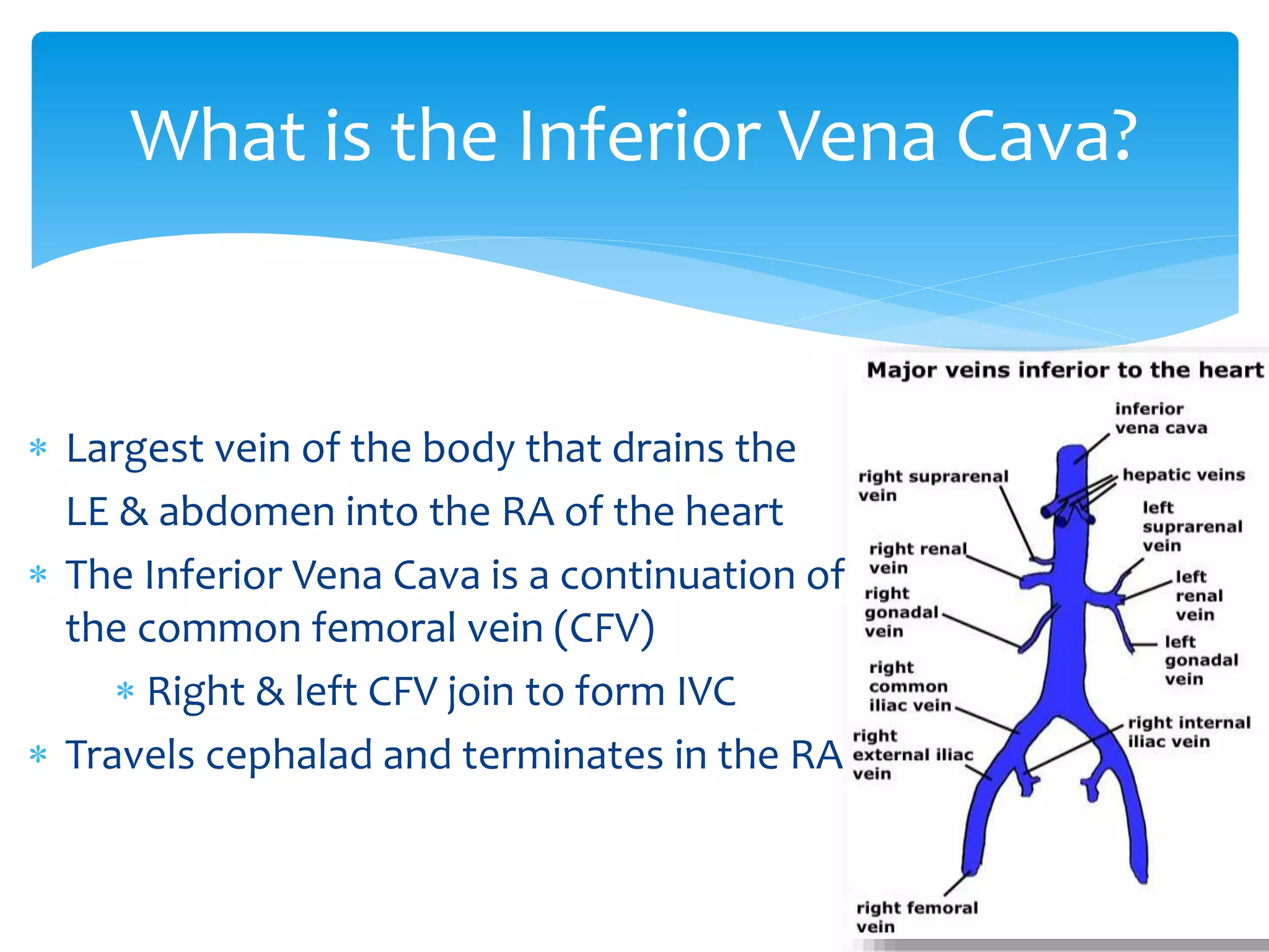 Inferior Vena Cava Disorders | PPTX