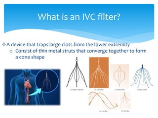 Inferior Vena Cava Disorders | PPTX
