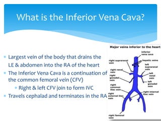 Inferior Vena Cava Disorders | PPTX